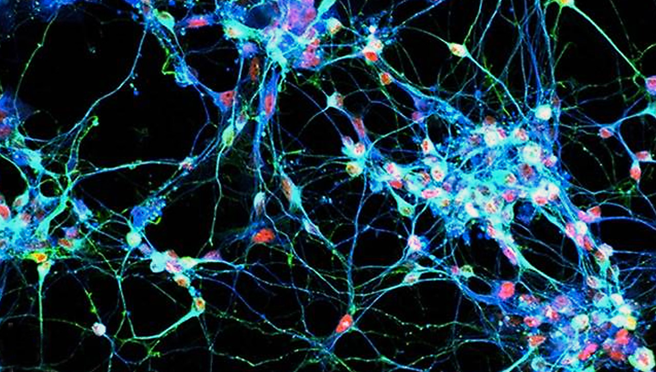 Generating The Neural Lineage From iPSCs - Bio-Trac®